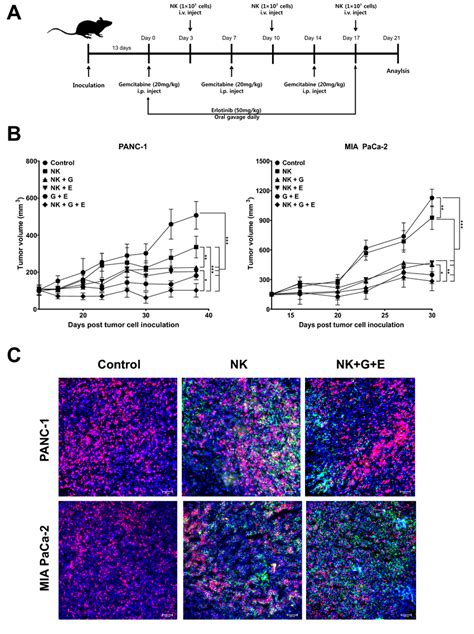 Effects Of Gemcitabine Based Chemotherapy And Ex Vivo Expanded Nk Cells