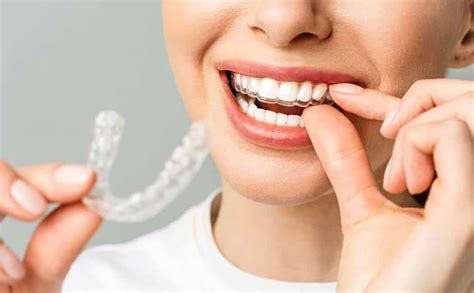 Invisalign The Good Dentist