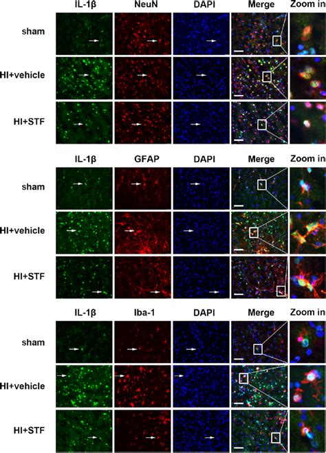 Representative Immunofluorescence Microphotographs Of Il 1β