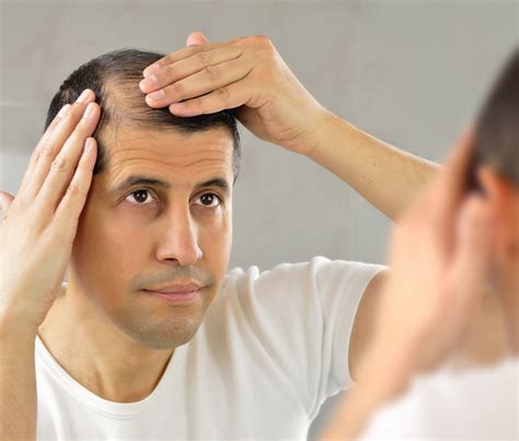 Best Hair Loss Treatment Clinic In Bhubaneswar Radiance Clinics