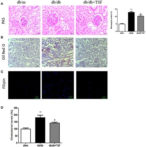 Frontiers Tangshen Formula Attenuates Diabetic Nephropathy By