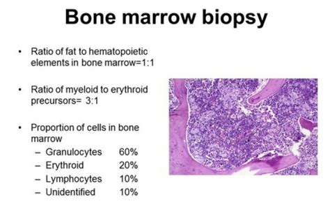 Myeloid To Erythroid Ratio Normal Is 3 1 Hematology Pathology
