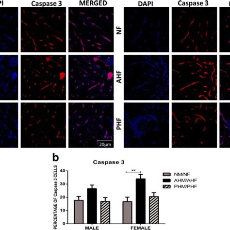 Sex Difference In Cell Death In Preconditioning Hypoxia Vs Acute