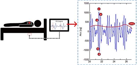Learn About Wearable Biosensors Element14 Community