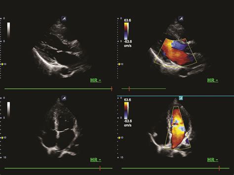 raw data post processing ais medical