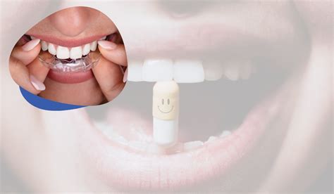 Bruxism Teeth Grinding Keep Your Dental Health In Perfect Shape