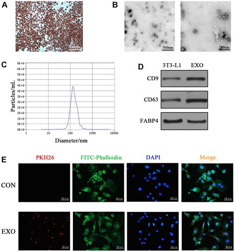 Adipocyte Derived Exosomal Mir 30c 5p Promotes Ovarian Angiogenesis In