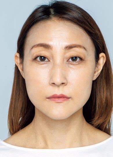 フェイスラインが整形級に変わった 顔プロポーション調整1カ月体験 Story [ストーリィ] オフィシャルサイト