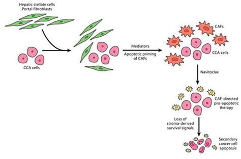 Molecular Pathogenesis Of Cholangiocarcinoma Digestive Diseases