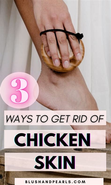 How To Get Rid Of Chicken Skin Keratosis Pilaris Remedy Blush And Pearls