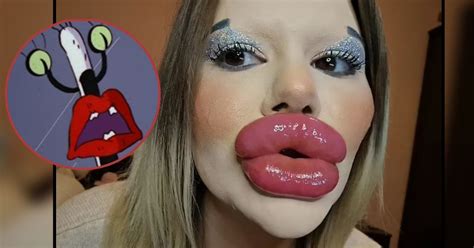 Fotos Mujer Con Los Labios Más Grandes Del Mundo Ahora Busca Un Nuevo