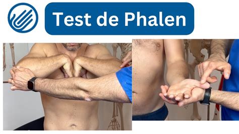 Prueba De Phalen Para El Síndrome Del Túnel Carpiano Youtube