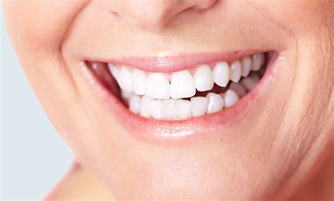 Teeth Whitening In Delhi Myths Vs Facts
