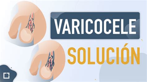 El Mejor Tratamiento Para El Varicocele Andromedi