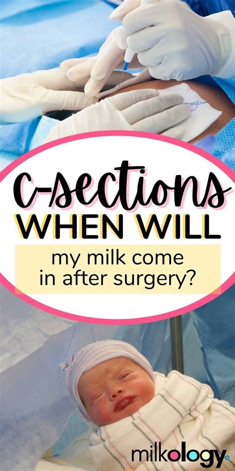 When Will My Milk Come In After C Section Surgery — Milkology®