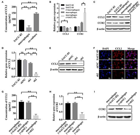 Frontiers Ccl2 Ccr2 Axis Promotes The Progression Of Salivary Adenoid