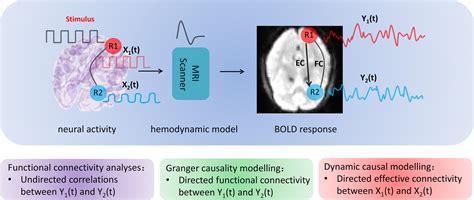 A Brain Network Model For Depression From Symptom Understanding To