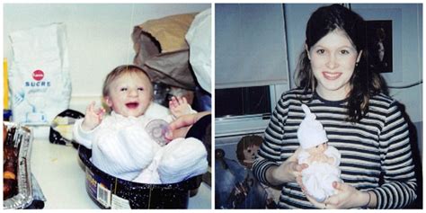 Thumbelina The Girl With Rare Form Of Dwarfism Now Is 12 Years Old