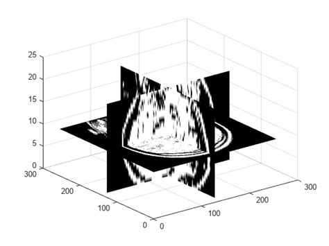 binarize 2 d grayscale image or 3 d volume by thresholding matlab