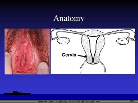 Pap Smear Technique Operational Obstetrics Gynecology Bureau Of