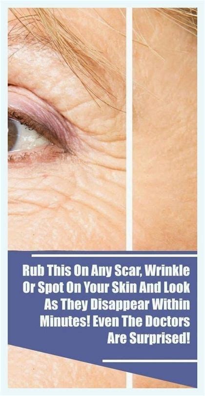 Rub This On Any Scar Wrinkle Or Spot On Your Skin And Look As They