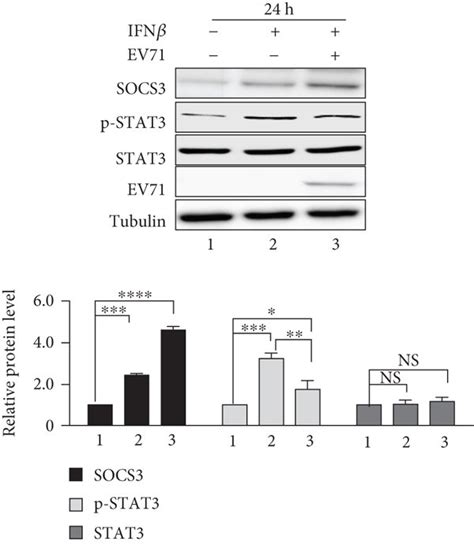 Ev71 Infection Activates Socs Expression Through The Nf κb Pathway And