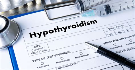 How Should You Take Your Hypothyroidism Medication Yourmeds