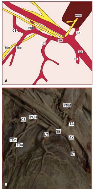 origin of the subscapular artery in the south african black population