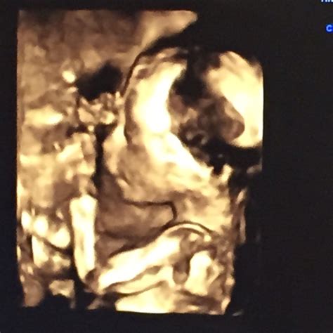 20w 3d She Was Hard To Get A Good Pic Of She Had Both Hands And Both