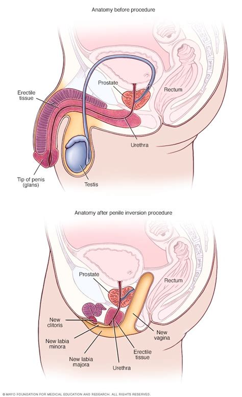 anatomy before and after penile inversion mayo clinic