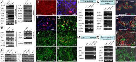 A Rosette Type Self Renewing Human Es Cell Derived Neural Stem Cell