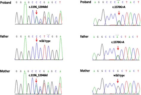 The Sequencing Chromatogram Of The Mutations From The Proband Patient