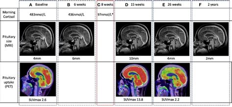 Frontiers Imaging For Assessment Of Cancer Treatment Response To