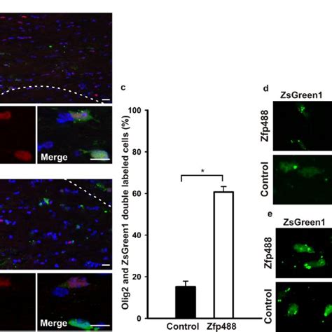 Zfp488 Directs The Differentiation Of Svz Progenitor Cells Into