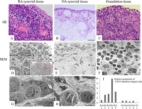 Association Of Cd90 Expression By Cd14 Dendritic‐shaped Cells In