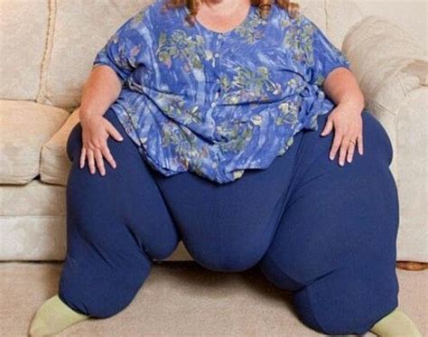 What Is A Fupa How To Get Rid Meaning Causes Before And After