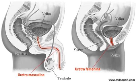 La Uretritis En Hombres Síntomas Causas Y Tratamientos