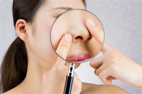 【医師監修】鼻の中のニキビは病院へ？ 痛みの原因と治し方｜ウーマンエキサイト 2 2