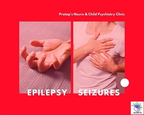 Difference Between Epilepsy And Seizures