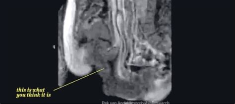 how a woman s internal organs move when she s pregnant on imgur