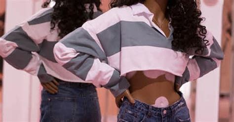 Mannequins With Stretch Marks Freckles And Vitiligo By U K Fashion