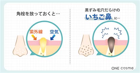 洗顔後の毛穴の「白いポツポツ」の正体とは？取り方や正しい毛穴ケアを知ってつるんと輝く透明肌に Onecosme