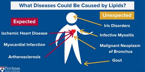 Lipids Model How To Explore For Unexpected Diseases Penn Today
