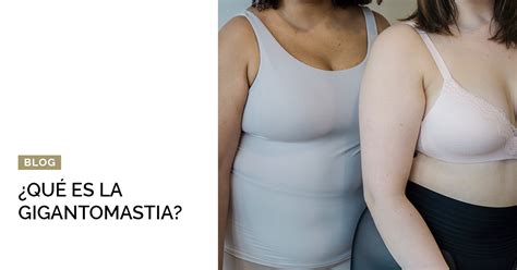 ¿qué Es La Gigantomastia
