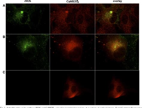 Figure 1 From Inos Regulation By Calcium Calmodulin Dependent Protein