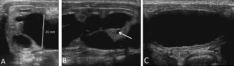 Multidisciplinary Consensus On The Classification Of Prenatal And