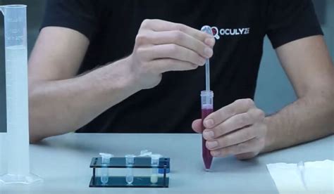 How To Test If Yeast Is Still Viable