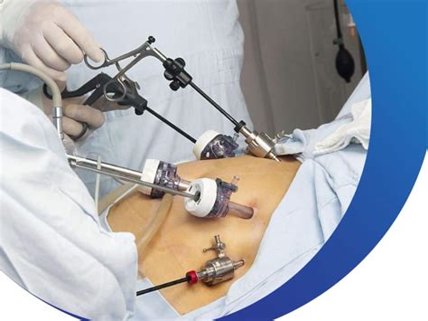 Laparoscopic Vs Vaginal Hysterectomy 5 Benefits Of Getting