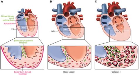 Jci Cardiac Fibroblasts In Pressure Overload Hypertrophy The Enemy
