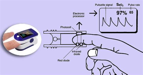 Pulse Oximetry Factors Impacting Accuracy
